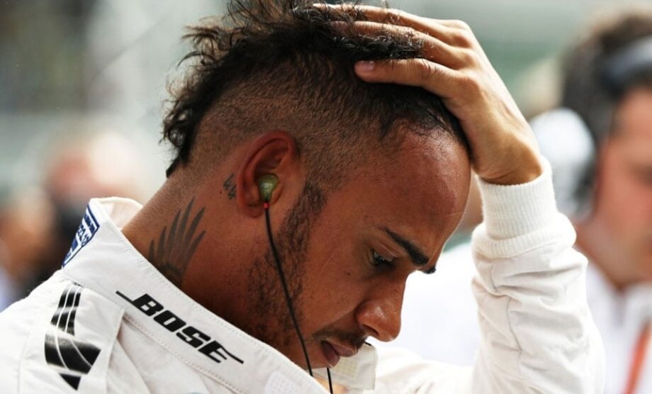 Balding Hairstyles - How To Style Your Hair When You're Losing It