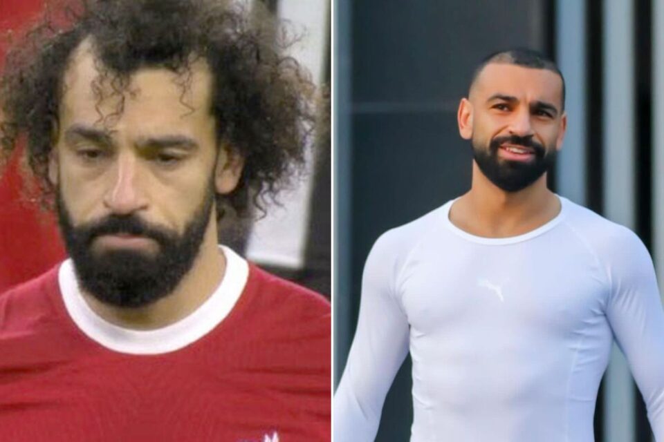 The Best And Worst Hair Transplants In Football History - DMARGE