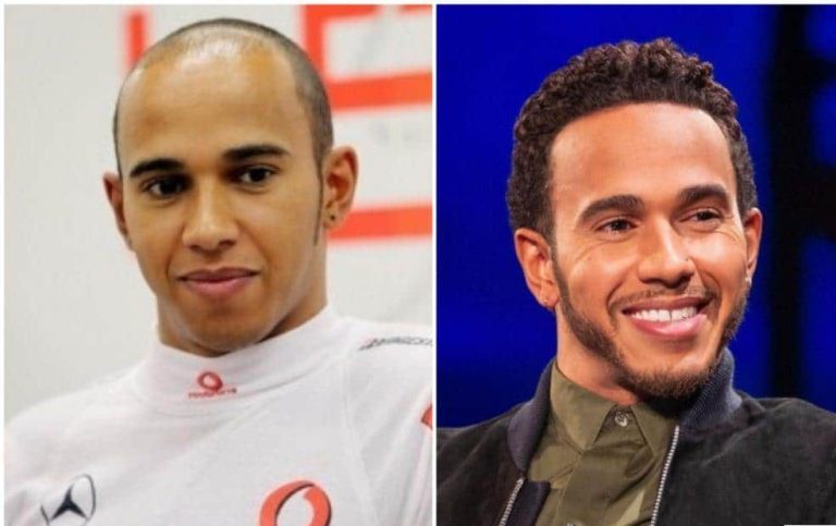 Pierre Gasly’s Hairline Gets a Seven-Time World Champion-Worthy Upgrade ...